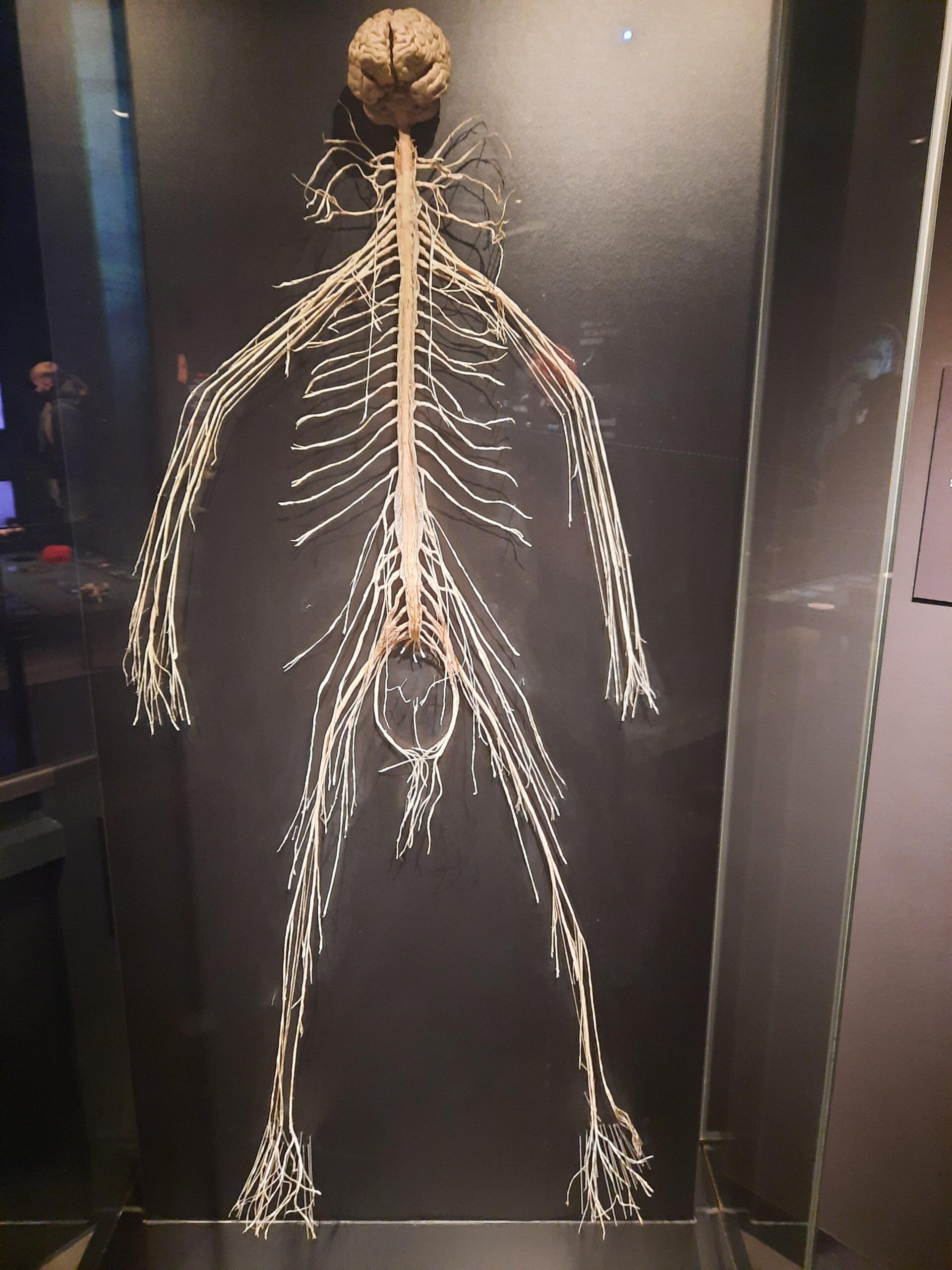 A plastinated human nervous system on display at an exhibition - USLUCK